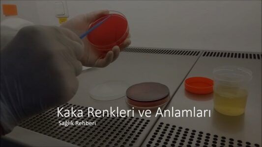 Kaka Renkleri ve Anlamları - SAĞLIKLI TÜRKİYE
